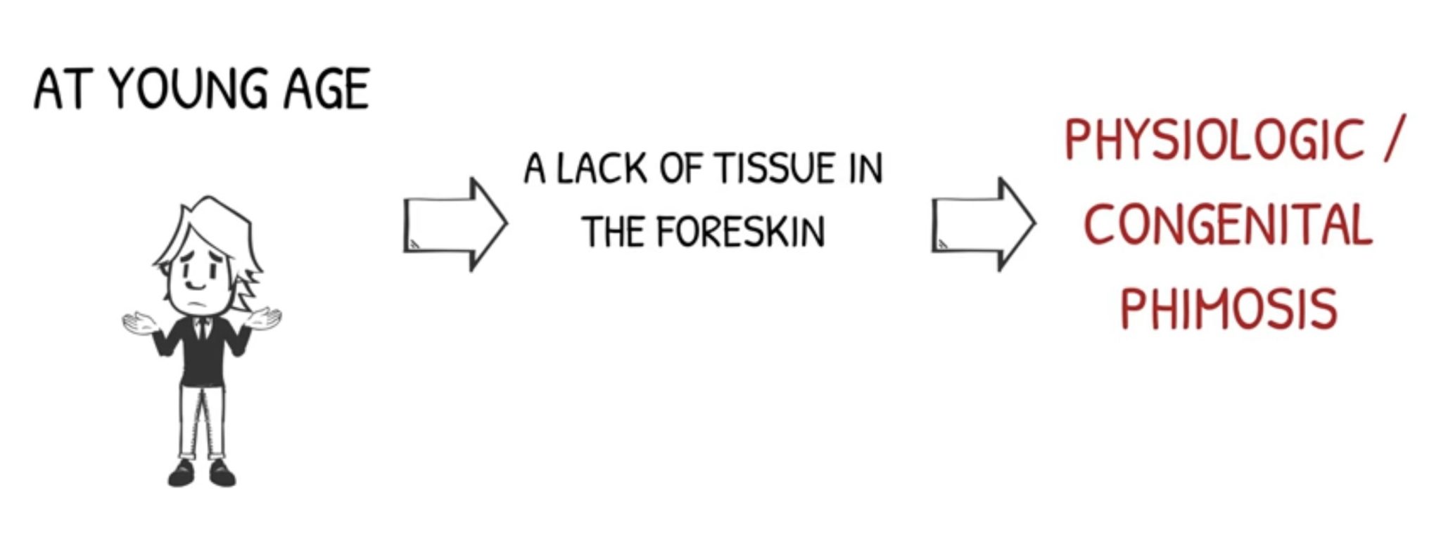 Phimosis: meaning, symptoms and treatment